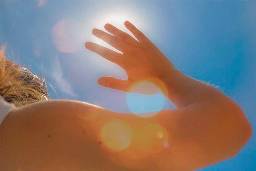 Alergia al sol, qué es, síntomas y cómo combatirla – Dra. Palmira Delgado